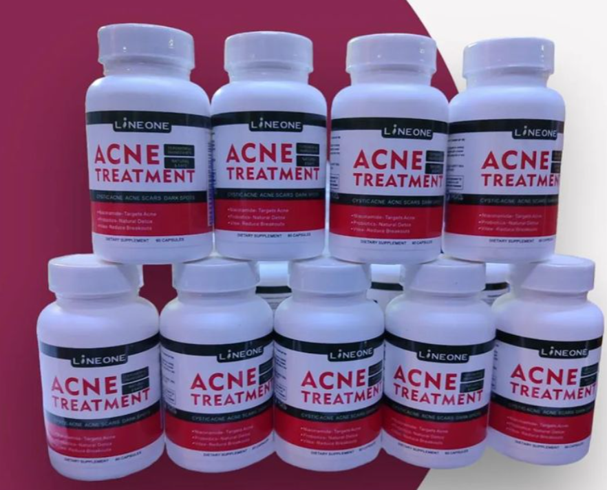 Best price for Acne Treatment Capsules | Dietary Supplement for Cystic ...