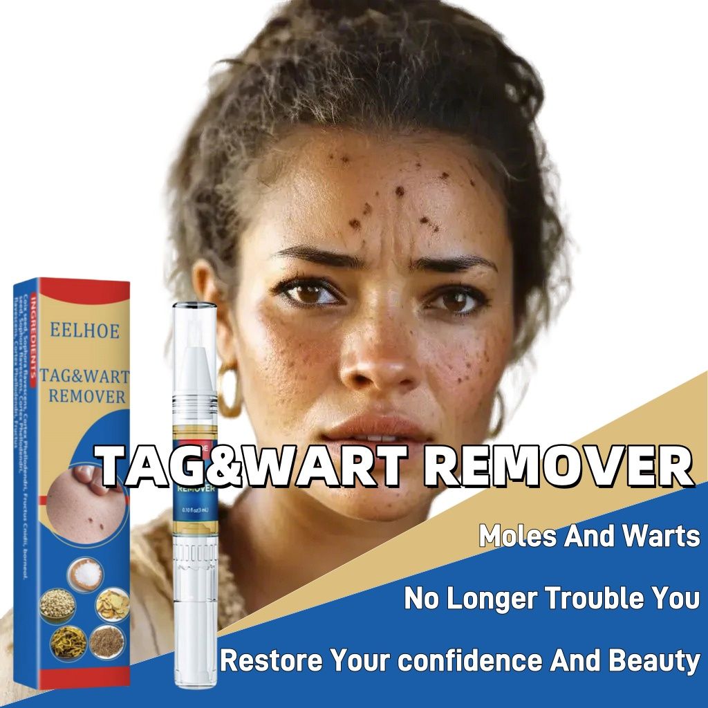 Best price for Black Mole And Wart Remover，safe And Painless ...