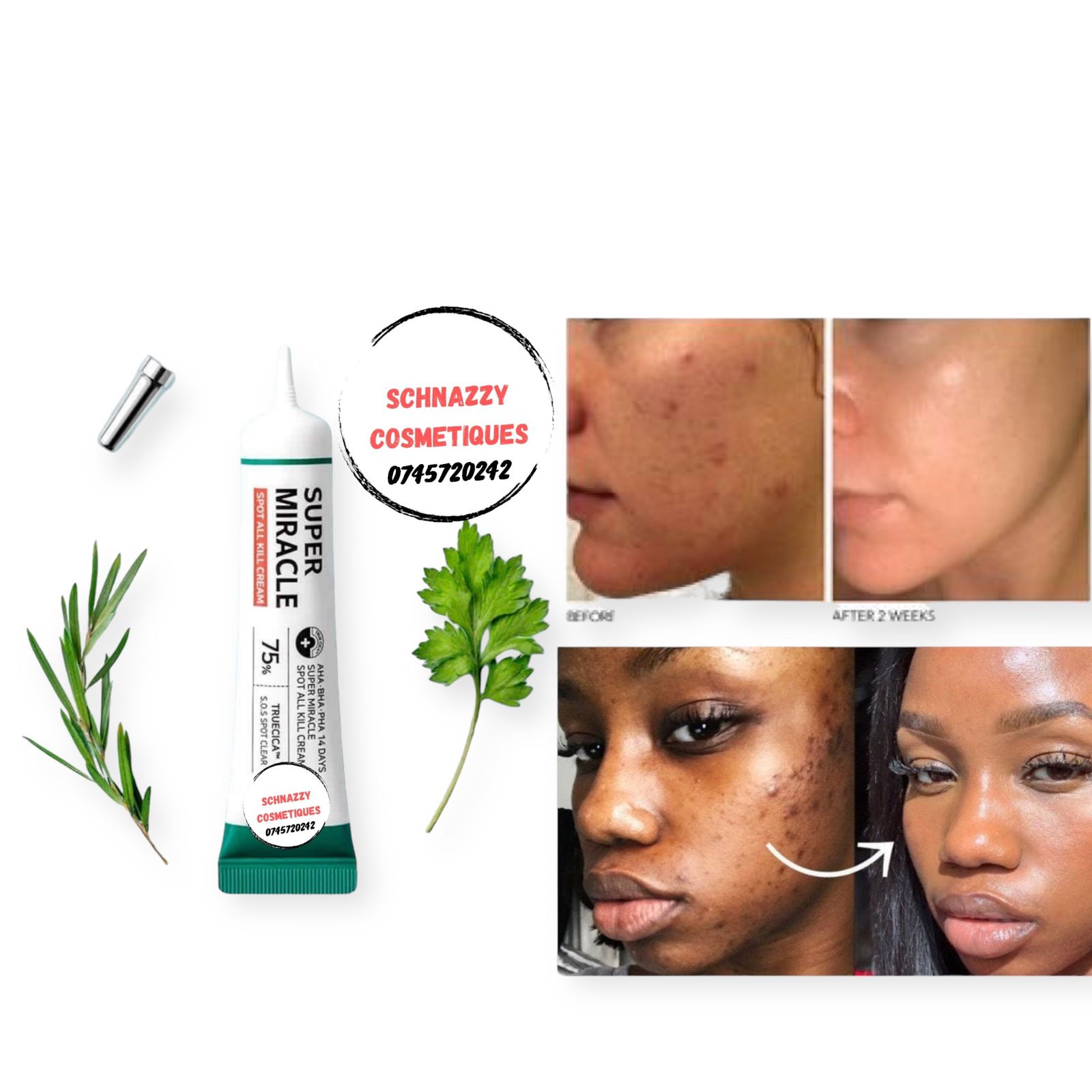 Best price for SUPER MIRACLE SPOT KILL CREAM Hypoallergenic Clear Spots ...