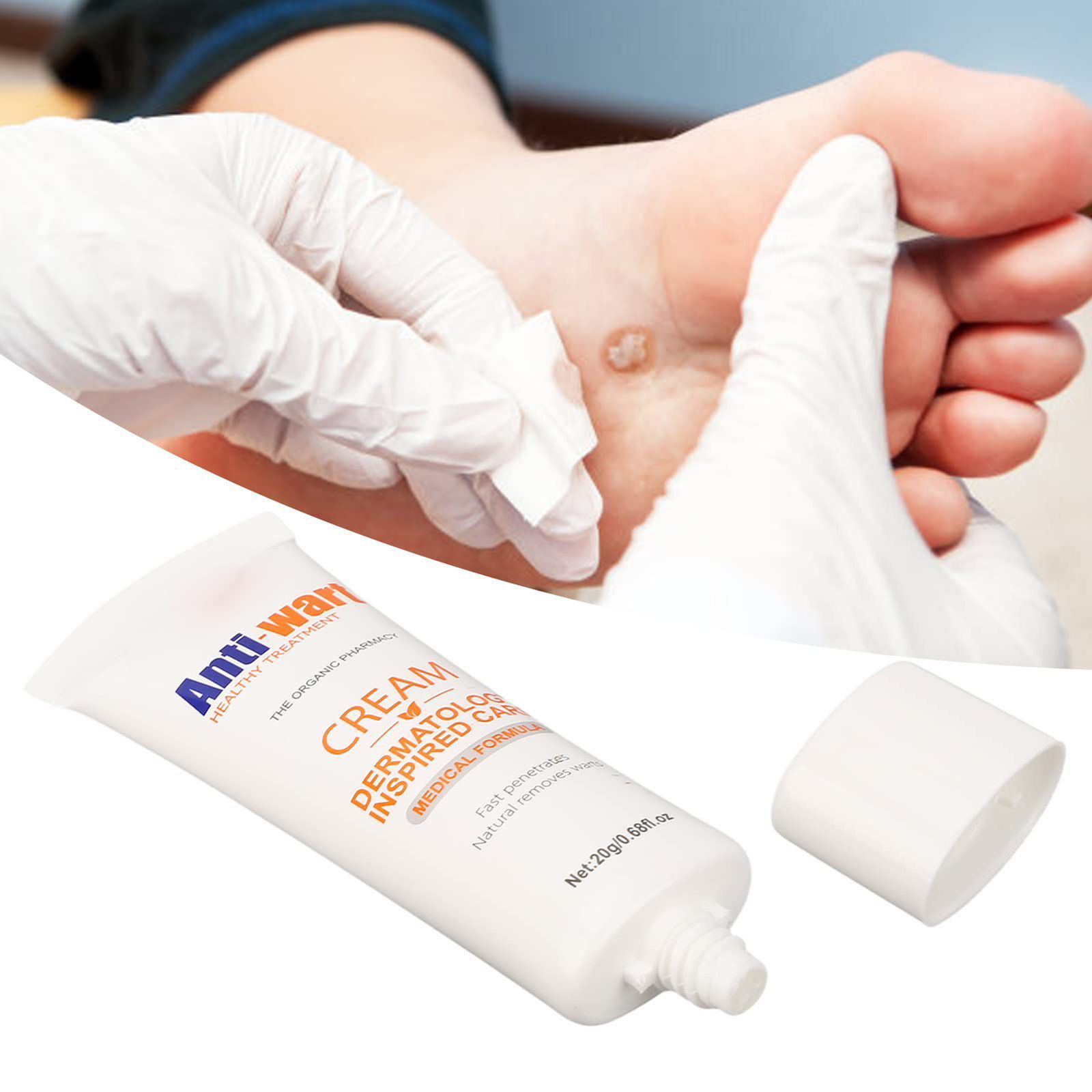 Best price for Anti-Wart Cream 20ml Effective Wart Treatment Long ...