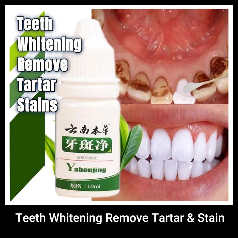 Best price for Teeth Whitening Teeth Cleaning Mousse Mouthwash ...