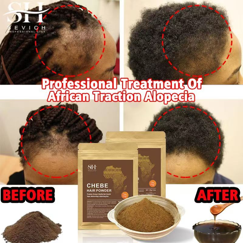 Best price for Africa Chad 100% Chebe Powder Women Traction Alopecia ...