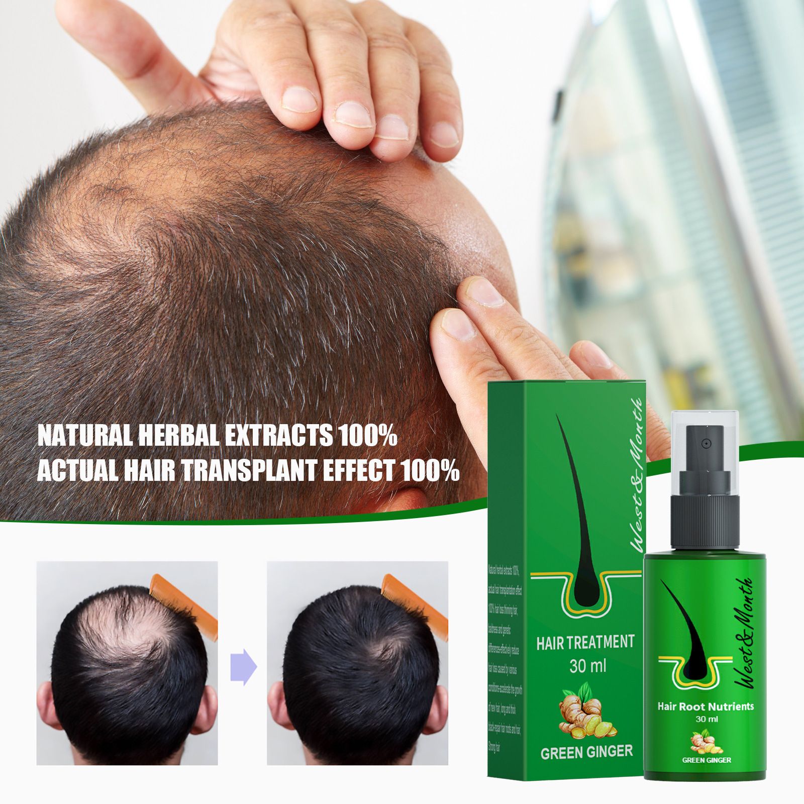 Best price for Ginger Hair Regrowth Serum Spray Germinal Liquid for ...