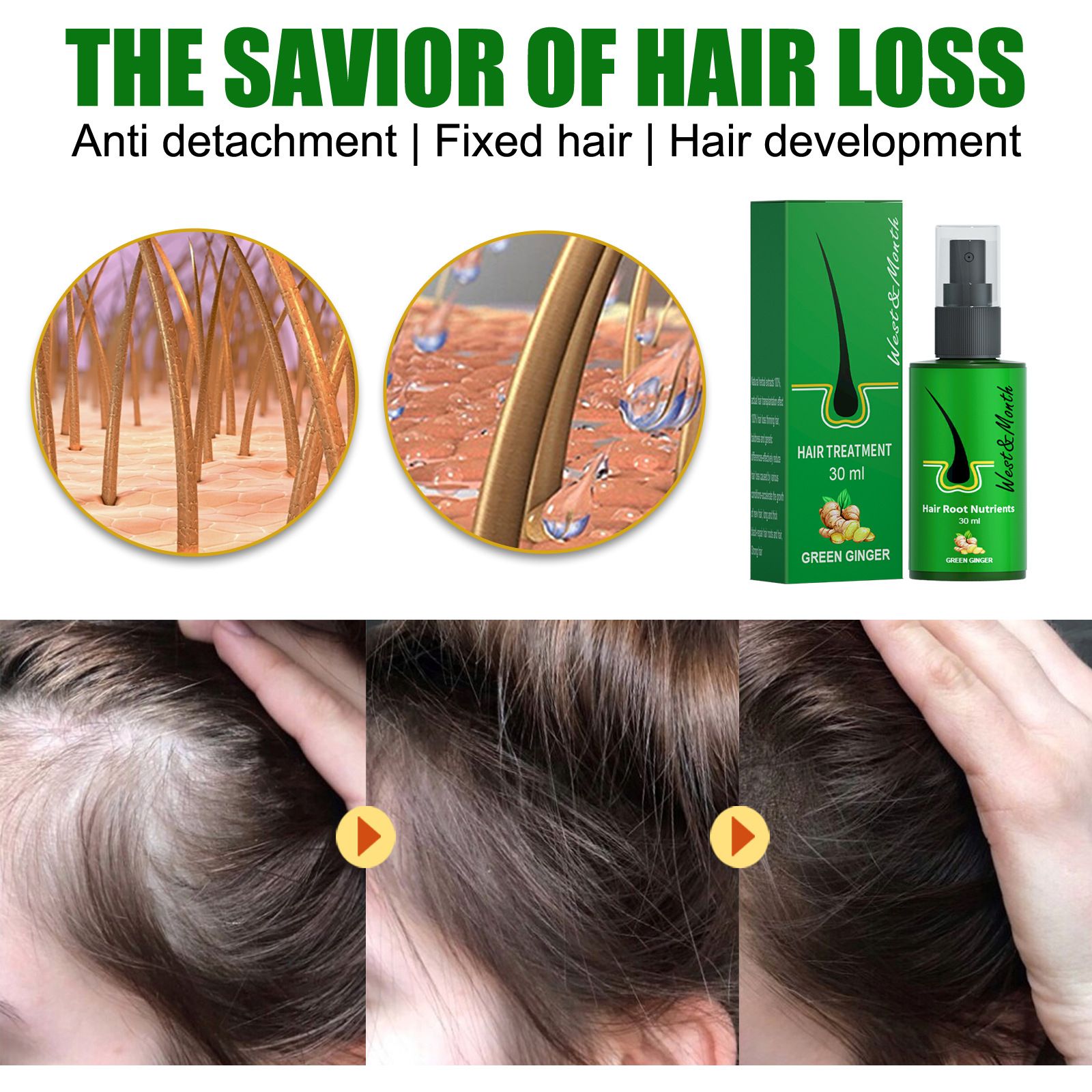 Best price for Ginger Hair Regrowth Serum Spray Germinal Liquid for ...