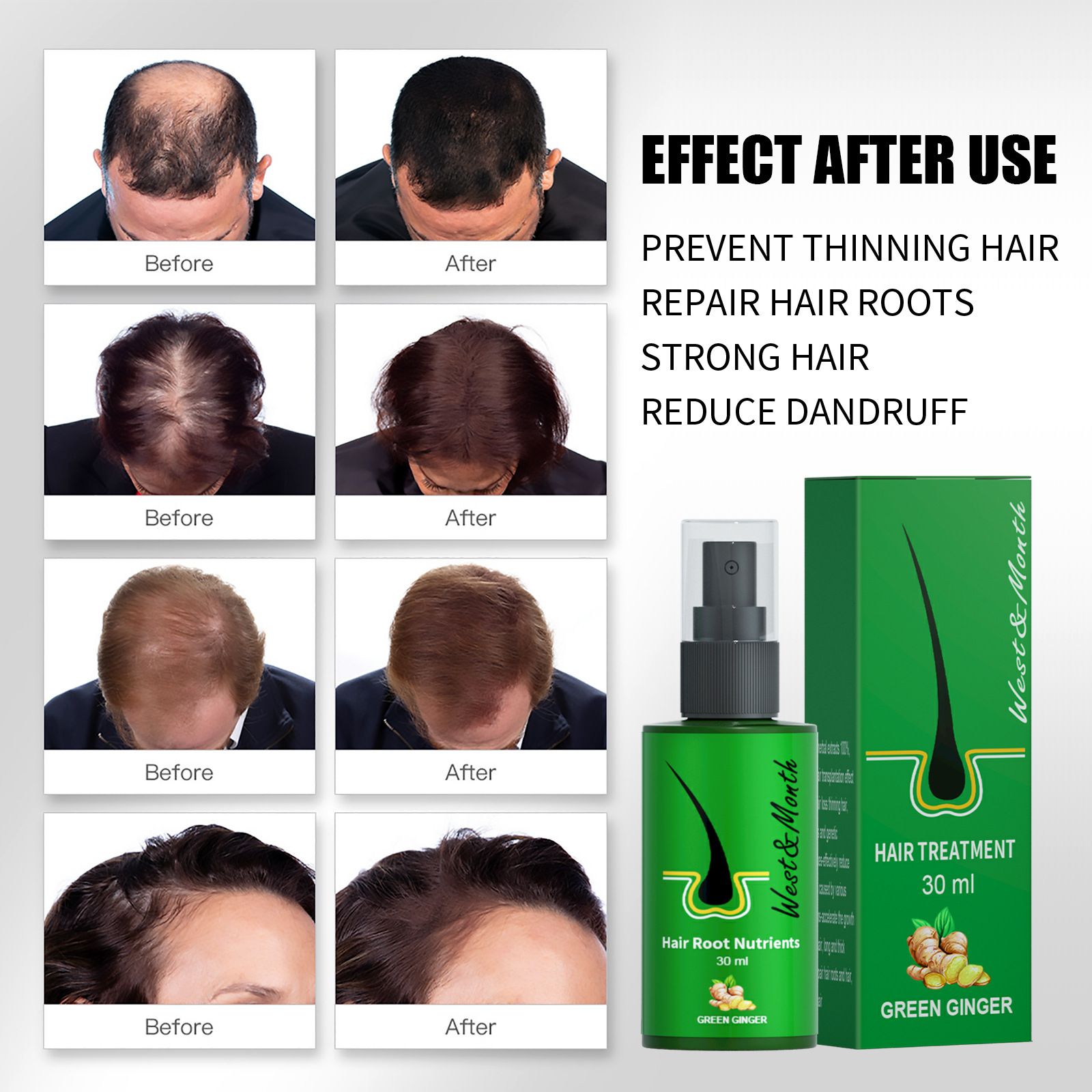 Best price for Ginger Hair Regrowth Serum Spray Germinal Liquid for ...