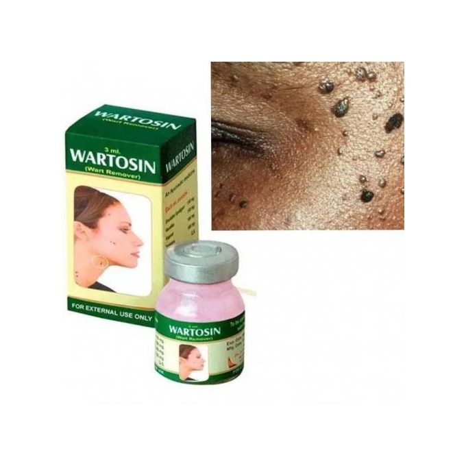 Best price for WARTOSIN Ayurvedic Warts Remover/Removal Cream Ointment ...