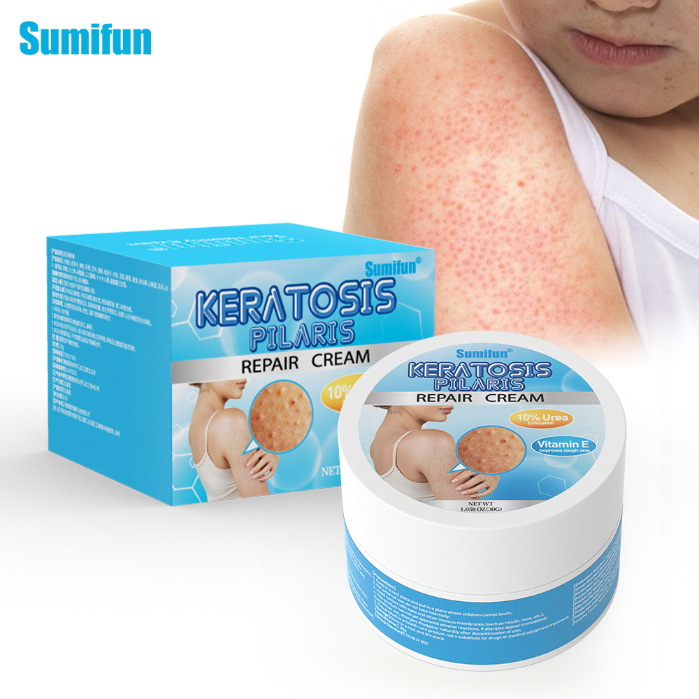 Best price for Sumifun Vitamin E Chicken Skin Cream Urea Pimple ...