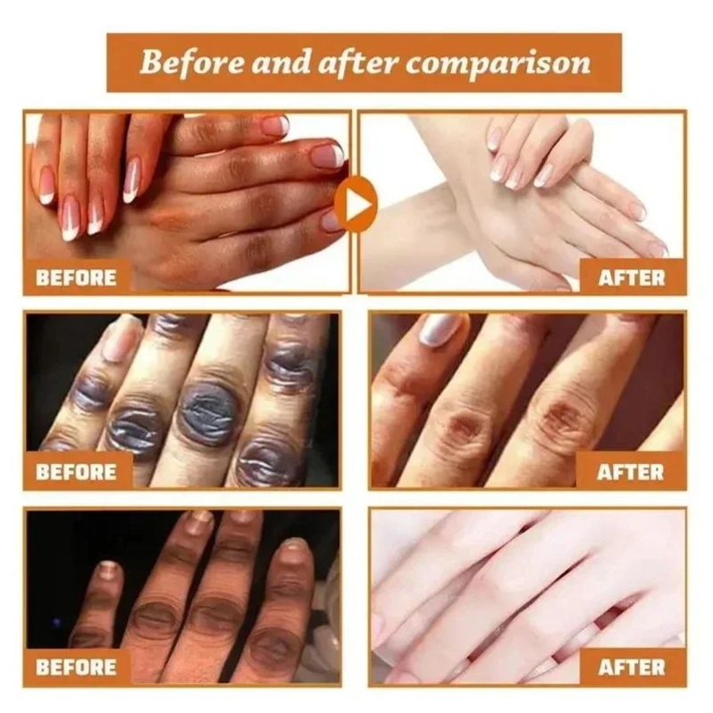 Best price for Dark Knuckles Fast Brighten Serum Elbows Hand Knuckle ...