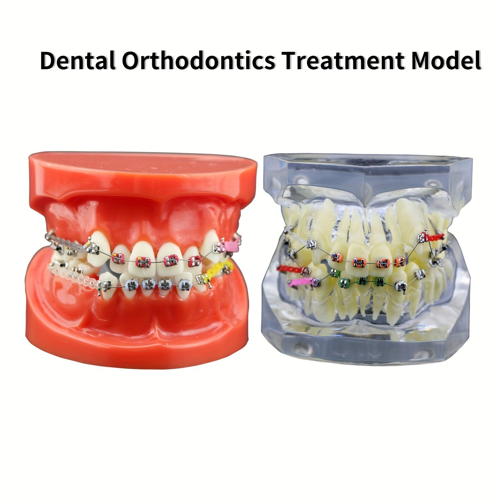 Best price for Dental Orthodontics Treatment Model With Metal Brackets ...