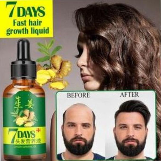 Best price for 7 Day King Of Ginger 7 Days Ginger Germinal Oil Hair ...