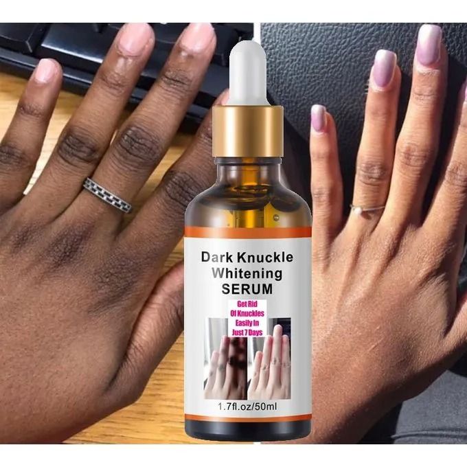 Best price for Women Elbow,Knees Knuckle Brightening Serum Dark ...