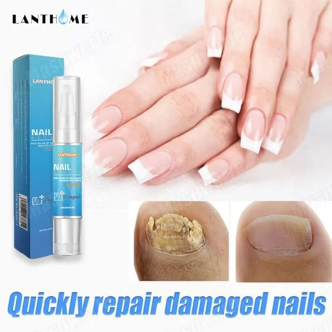 Best price for 7 Days Nail Fungal Treatment Essence Oil Foot Toe Nail ...