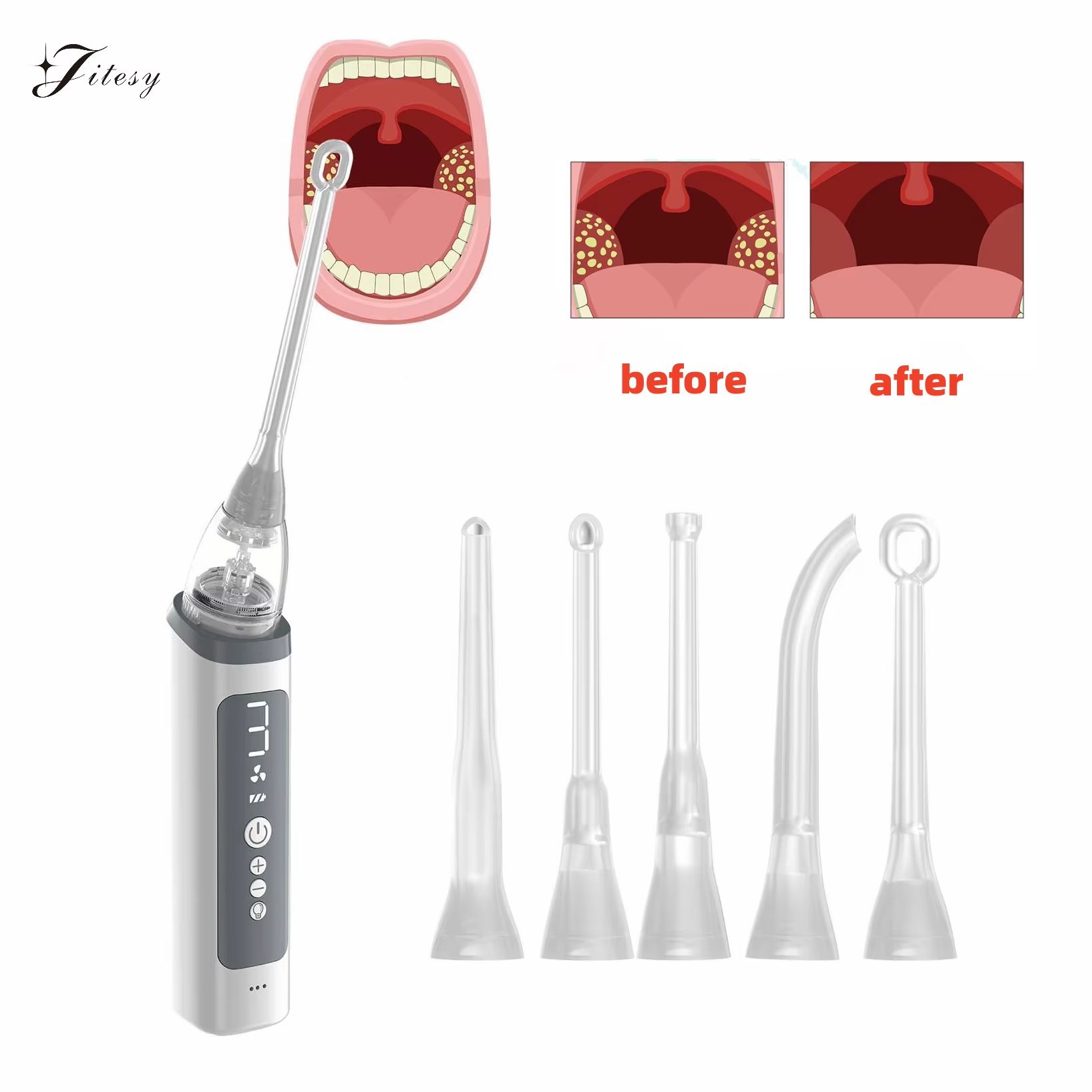 Best price for Vacuum Tonsil Stone Remover Tool Built-In LED light 8 ...