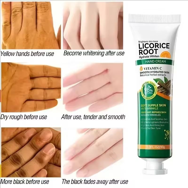 Best price for Brightening Dark Knuckles Cream Brighten Hand Cream ...