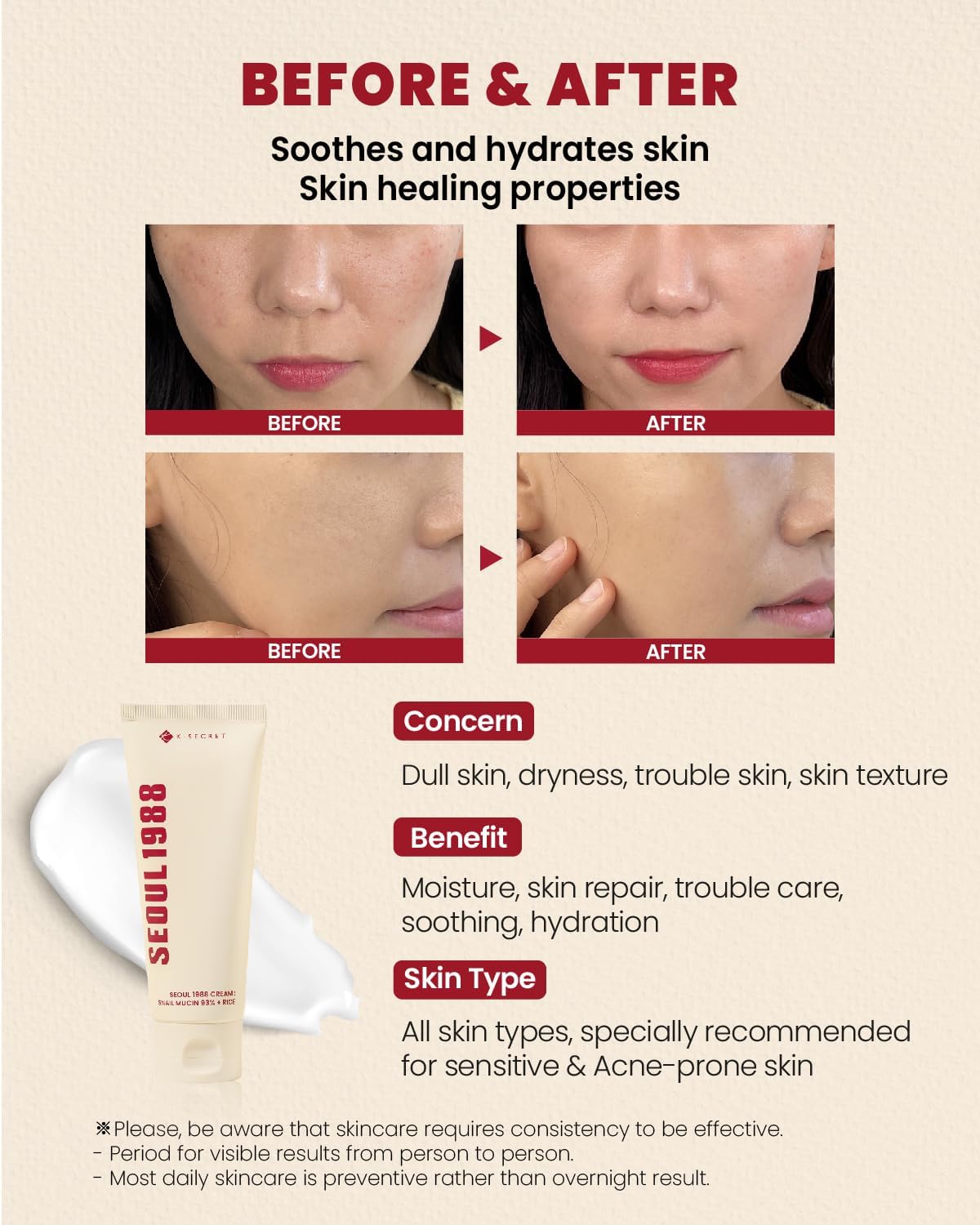 Best price for K-Secret Seoul 1988 Cream with Snail Mucin 93% + Rice ...