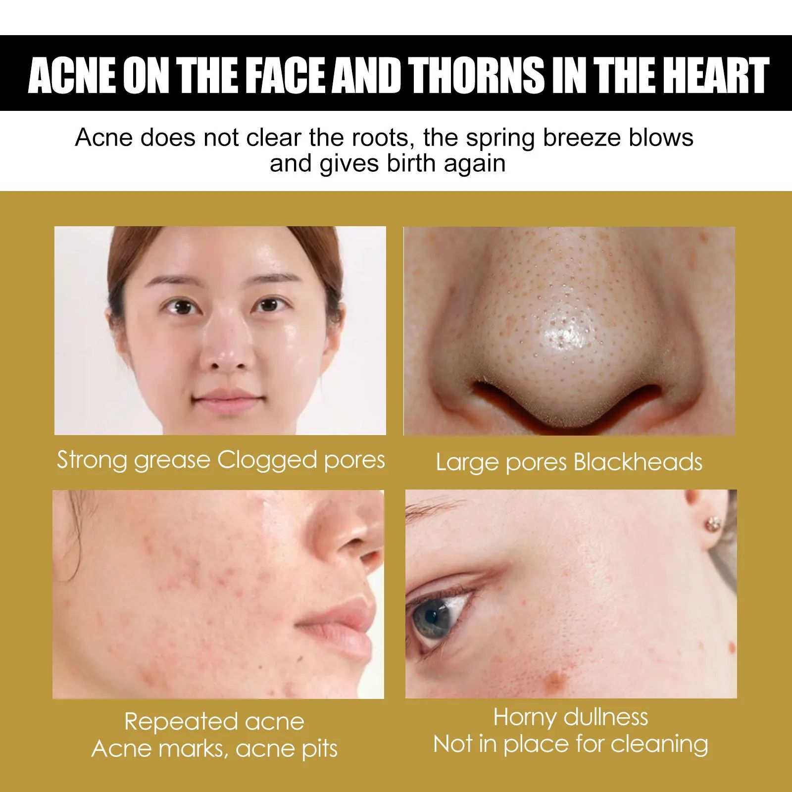 Best price for Snail Face Cream Anti Redness Pimple Removal Shrink Pores Repair Sensitive Skin ...