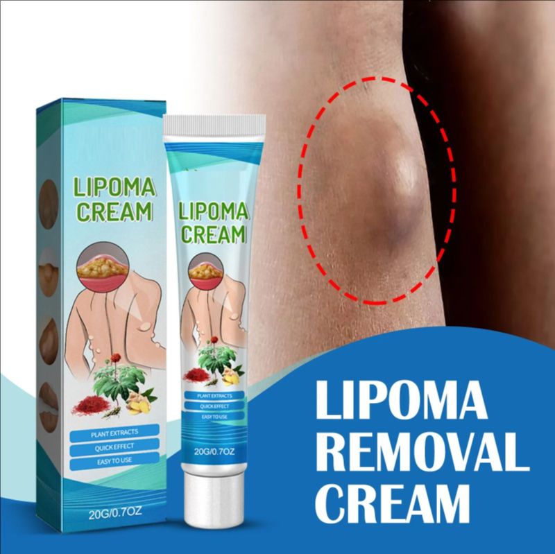 Best price for Lipoma Removal Cream Lipolysis Fat Lump Relief Plaster ...