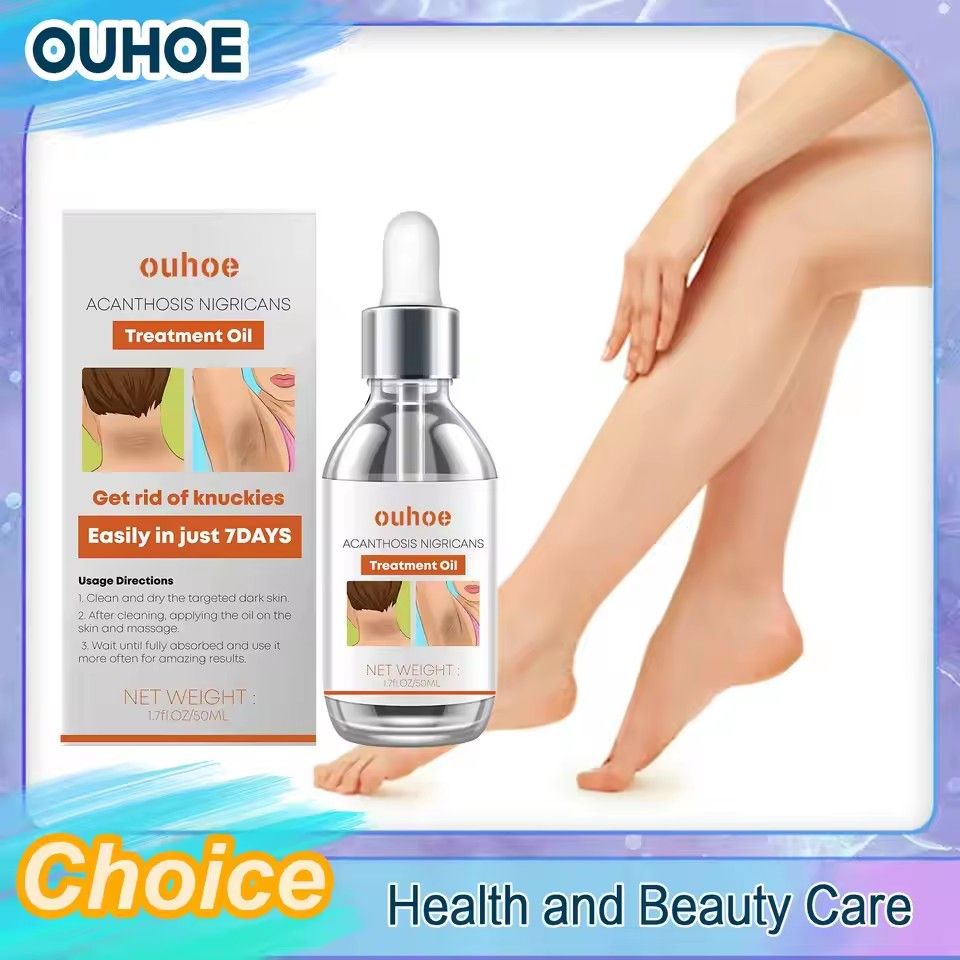 Best price for Dark Knuckle Whit-ening Serum Get Rid of Dark Knuckles ...