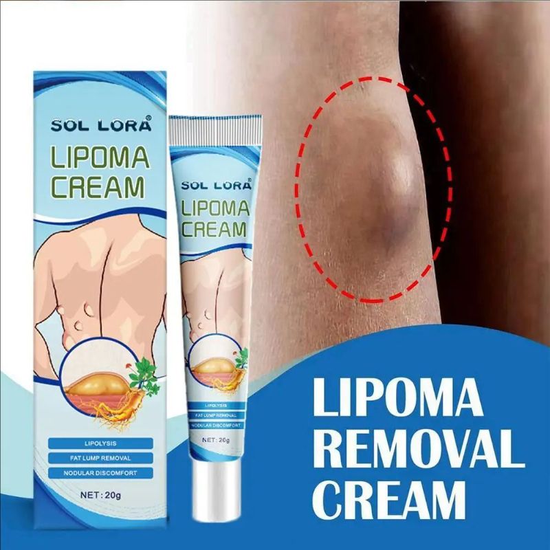 Best price for Lipoma Removal Cream Lipolysis Fat Lump Relief Plaster ...