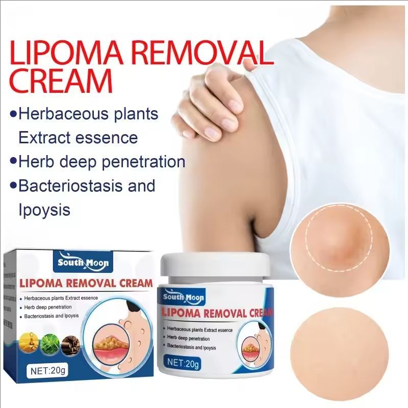 Best price for Lipoma Removal Ointment Cellulite Treatment Fibroma ...