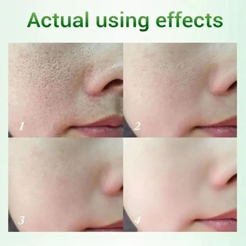 Best price for Salicylic Acid Pore Shrinking Cream Quick Remove Blackehead Smooth Skin Tighten ...