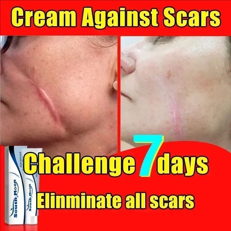 Best price for Scar Removal Cream Old Scar Cream Effective Repair New ...