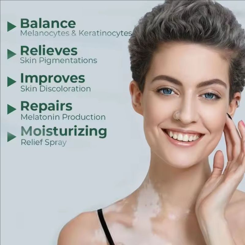 Best price for Skin Relief Cream Eliminate White Mark Repairing ...