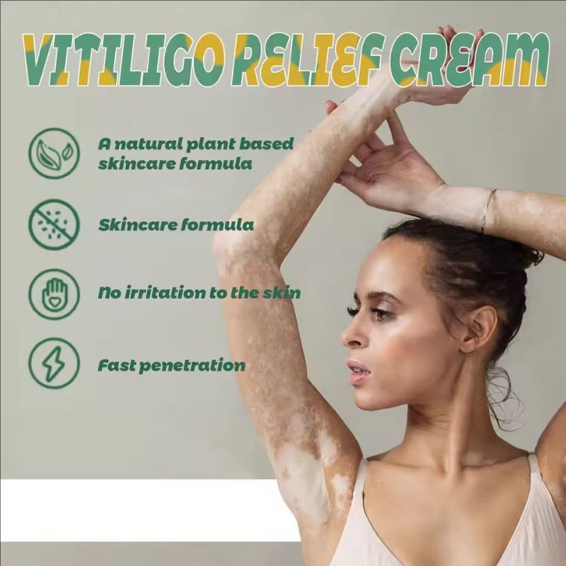 Best price for Skin Relief Cream Eliminate White Mark Repairing ...