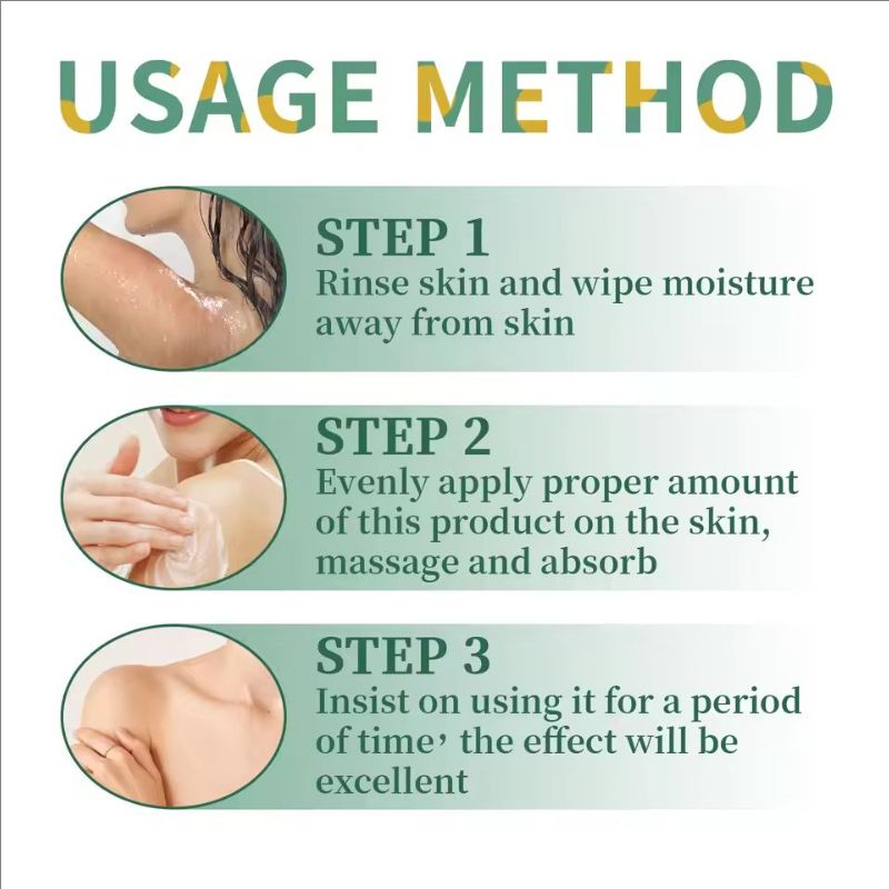 Best price for Skin Relief Cream Eliminate White Mark Repairing ...