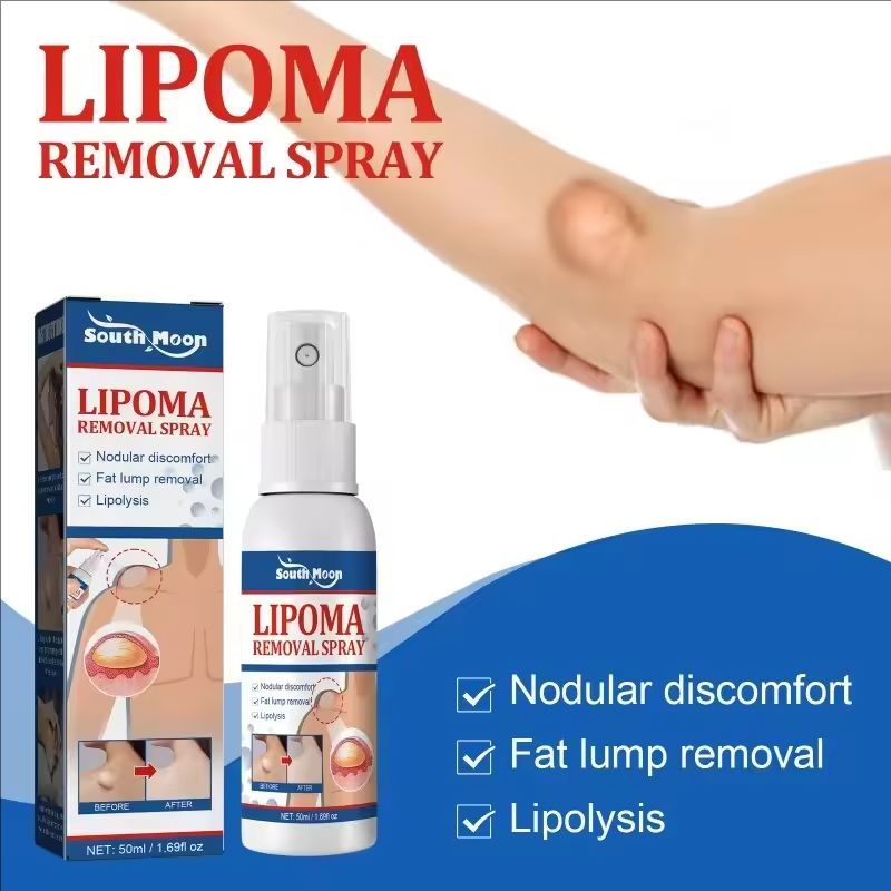 Best price for Lipoma Removal Medicines Spray Fibroma Cellulite Remover ...