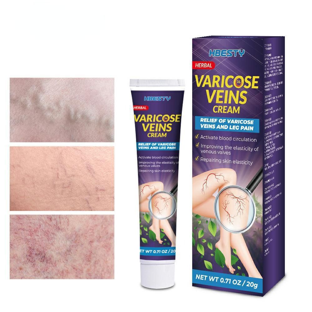 Best price for Venous ointment Qu Zhang massage Gel Earthworm leg vein ...