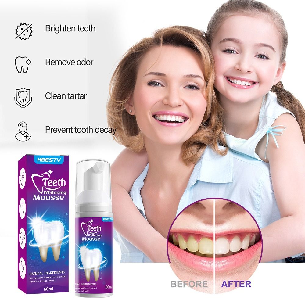 Best price for Bright white scaling Muse fresh tone Tooth yellow Tartar ...